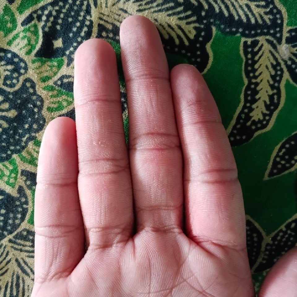 Panjang Jari Manis Ungkap Sifat dan Kepribadian, Ini Penjelasan ...